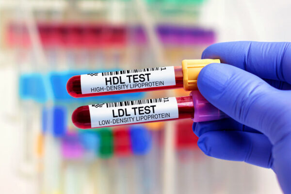 LDL vs HDL: 3 Lifestyle Changes To Get Your Cholesterol Under Control ...